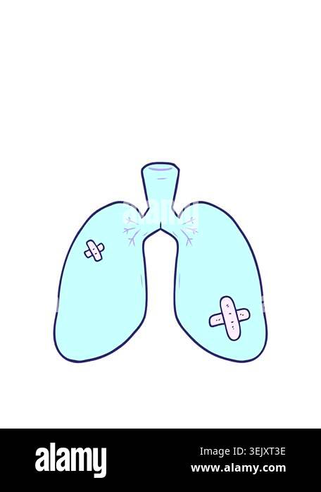 stretching up animation of cartoon repaired lungs Stock Video Footage ...