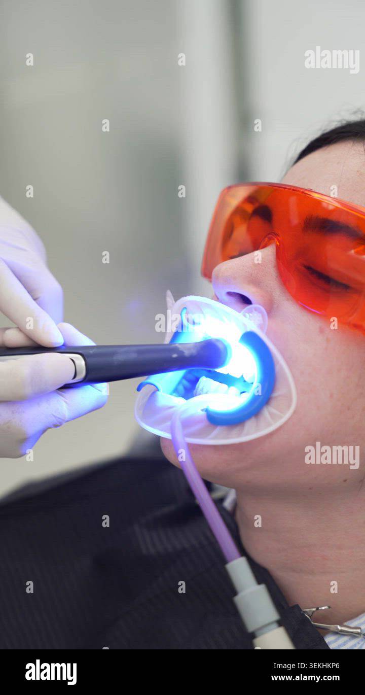 Dentist performing uv light teeth whitening procedure Stock Video ...