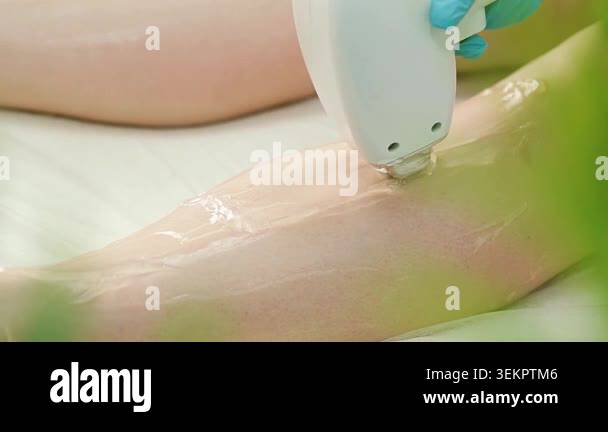 Beauty master makes laser hair removal epilation of legs skin close-up ...