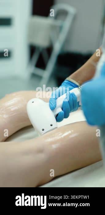 Beauty master makes laser hair removal epilation of legs skin close-up ...