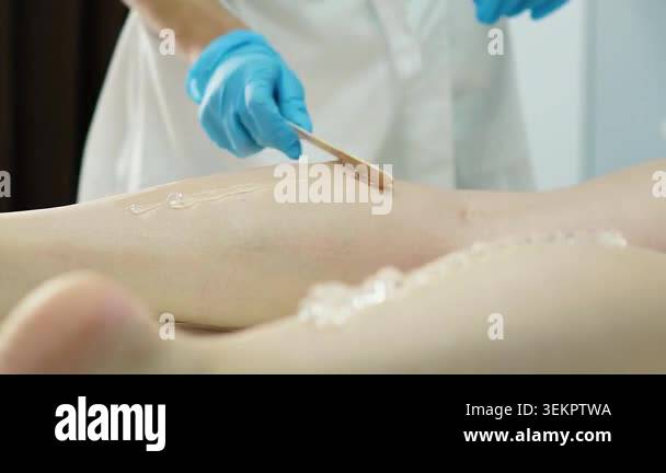 Beauty master makes laser hair removal epilation of legs skin close-up ...