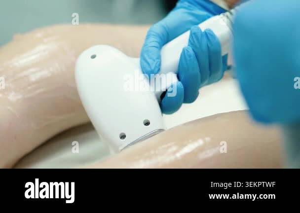 Beauty master makes laser hair removal epilation of legs skin close-up ...