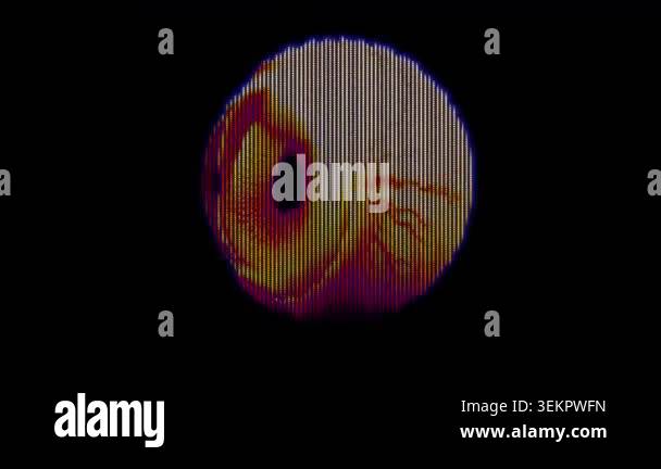 Glowing analog glitch human eye iris macro loop with vertical scanlines ...
