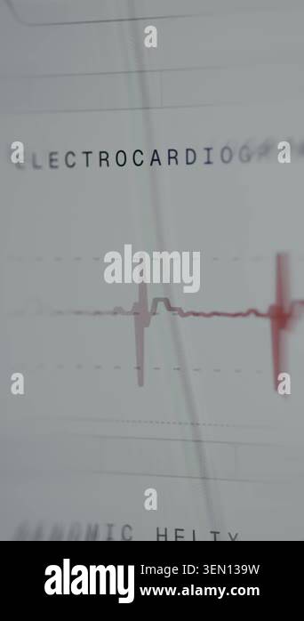 Digital electrocardiogram waveform showing cardiac monitoring activity ...