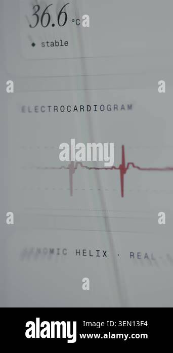 Medical ECG screen performing real-time heart monitoring Stock Video ...