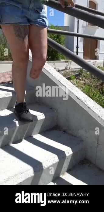Woman with a leg amputation confidently navigating concrete stairs ...