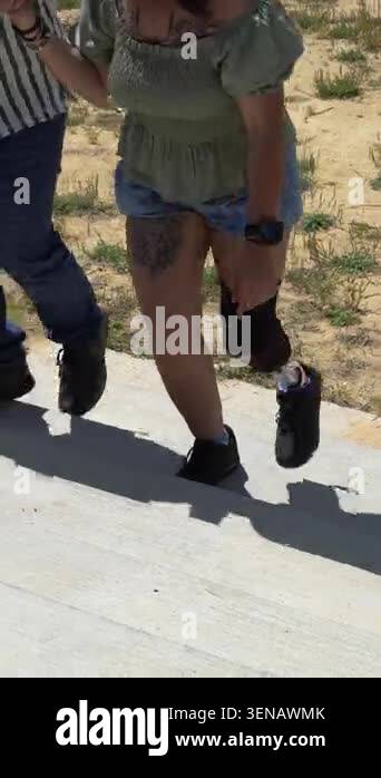 Courageous young woman with a leg prosthesis walking down stairs with a ...