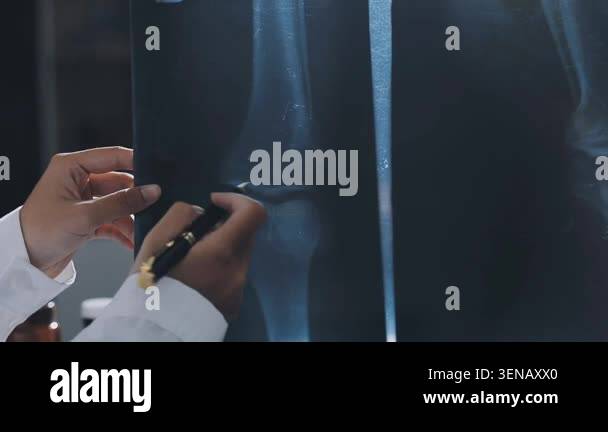 doctor examining x x - ray of the patient in the office, medical ...