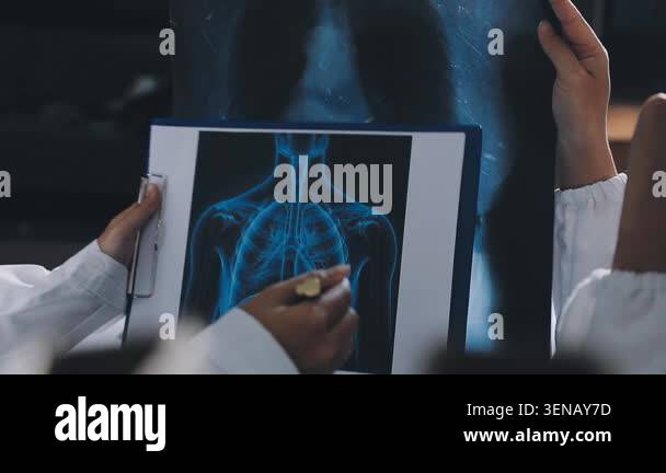 doctor holding x - ray picture of a patient Stock Video Footage - Alamy