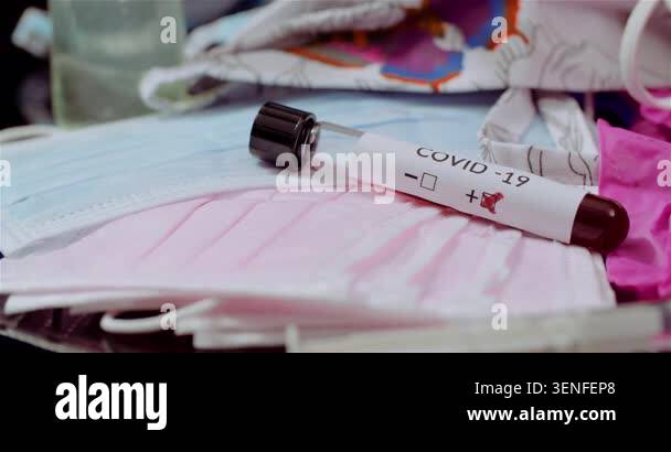 Close-up of a labeled sample tube lying across a light blue medical ...