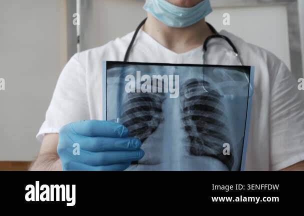 A doctor diagnoses the disease lung cancer in the office, a radiologist ...