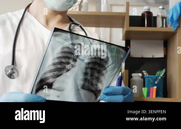 A doctor diagnoses the disease lung cancer in the office, a radiologist ...