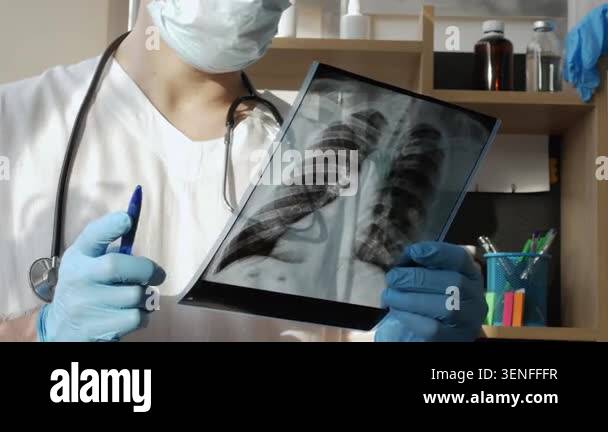 A doctor diagnoses the disease lung cancer in a hospital office, a ...
