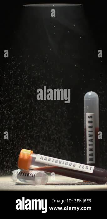 Super slow motion hantavirus test tubes with smoke in dark cinematic ...