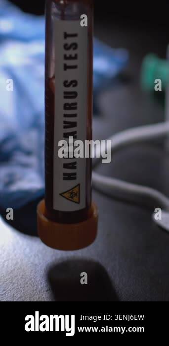 Super Slow Motion Upright Hantavirus Test Vial On Tabletop, Super Slow ...