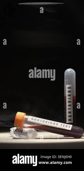 Super Slow Motion Quiet Aftermath Lab Sample Vials Resting On Bench ...