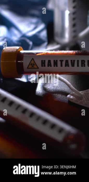 Super Slow Motion Label Reveal Hantavirus Test Tube Closeup, Super Slow ...