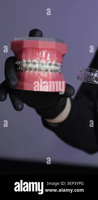 Dentist holding a jaw model with traditional braces and an invisible ...