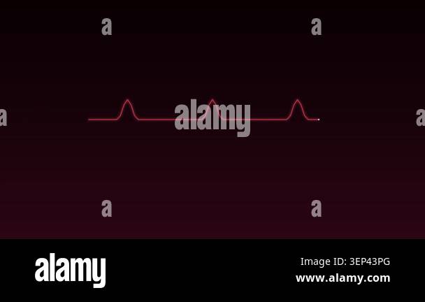 Animated heart rate pulse line on black background Stock Video Footage ...