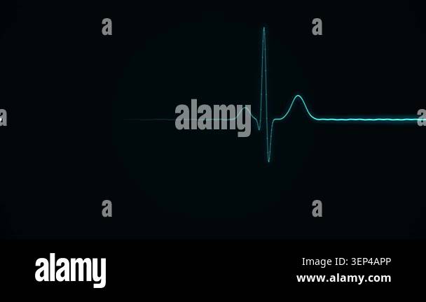 Heartbeat flatline Animation pulse trace Stock Video Footage - Alamy