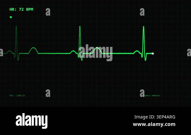 ecg cardiograph animation heart rate Stock Video Footage - Alamy