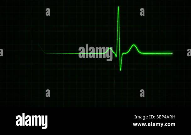 ecg cardiograph Heart Rate Monitor Stock Video Footage - Alamy