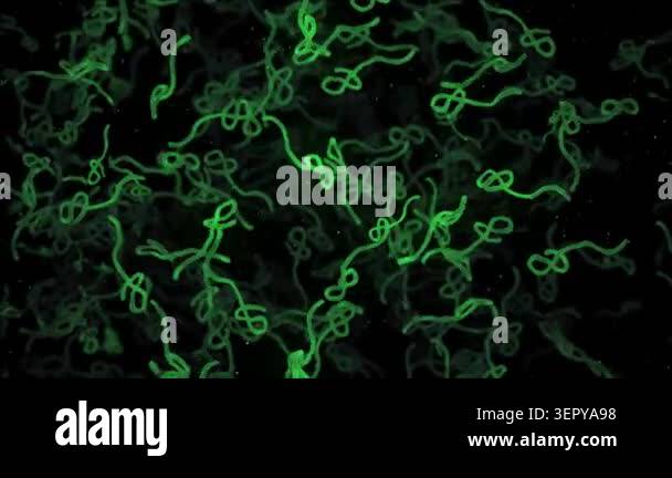 Microscopic view of infectious Ebola Virus cells or virions colored ...