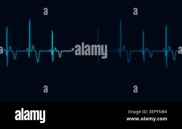 A cyan and blue glowing electrocardiogram pulse line moves across a ...