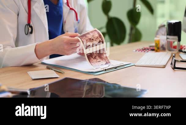 Woman doctor analyzes patient ultrasound images at office desk in ...