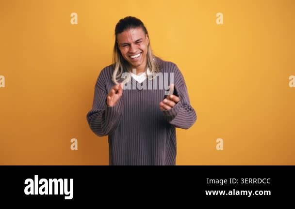 Cheerful long haired man with vitiligo laughing heartily and clapping ...