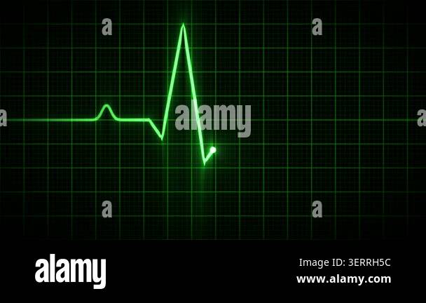 A seamless loop of a green glowing heart rate monitor pulse line moving ...