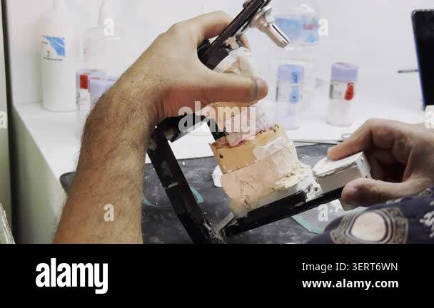 Working Process with Porcelain Zirconium Tooth Molds in the Dental ...