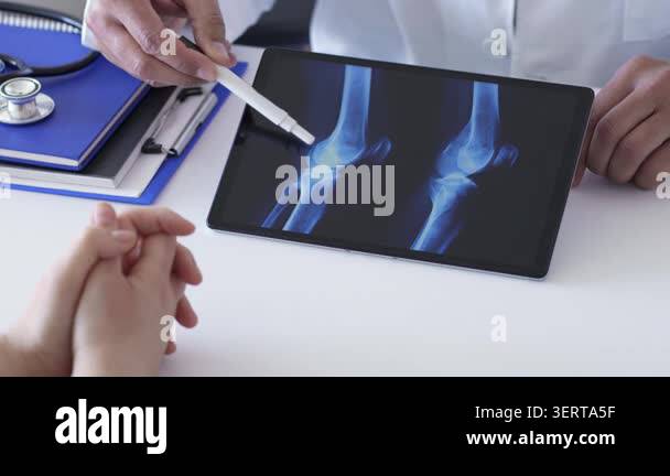 Hands, male doctor and tablet for x ray with knee, scan or osteoporosis ...
