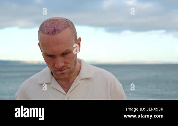 A frontal portrait of a serious and calm Caucasian man showing healing ...