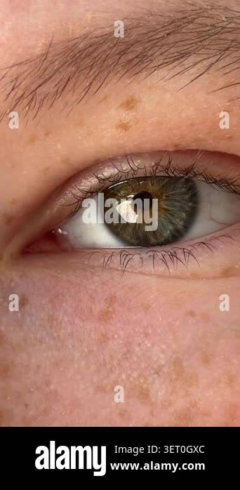 Extreme close-up of a young girls green-gray eye with golden brown ...