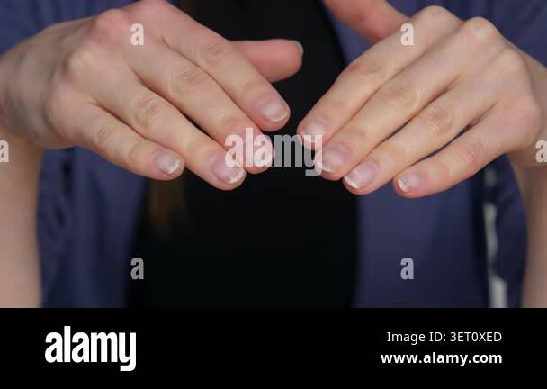 Close up of female hands showing damaged natural nails and red ...