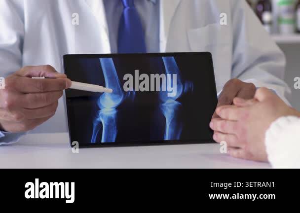 Hands, male doctor and tablet for x ray with knee, scan or osteoporosis ...