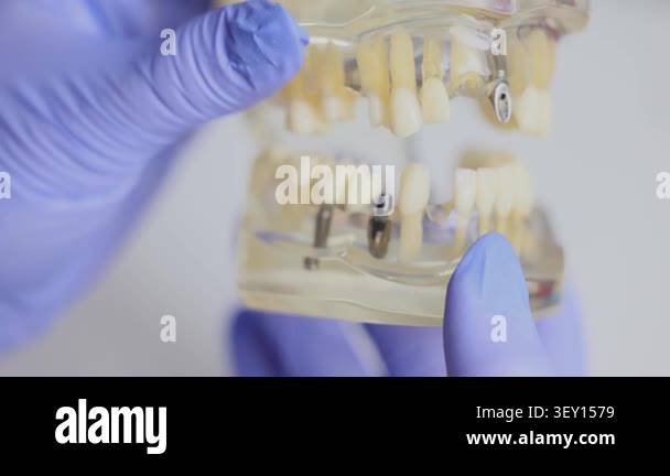 Transparent plastic typodont model with tooth roots for dental training ...