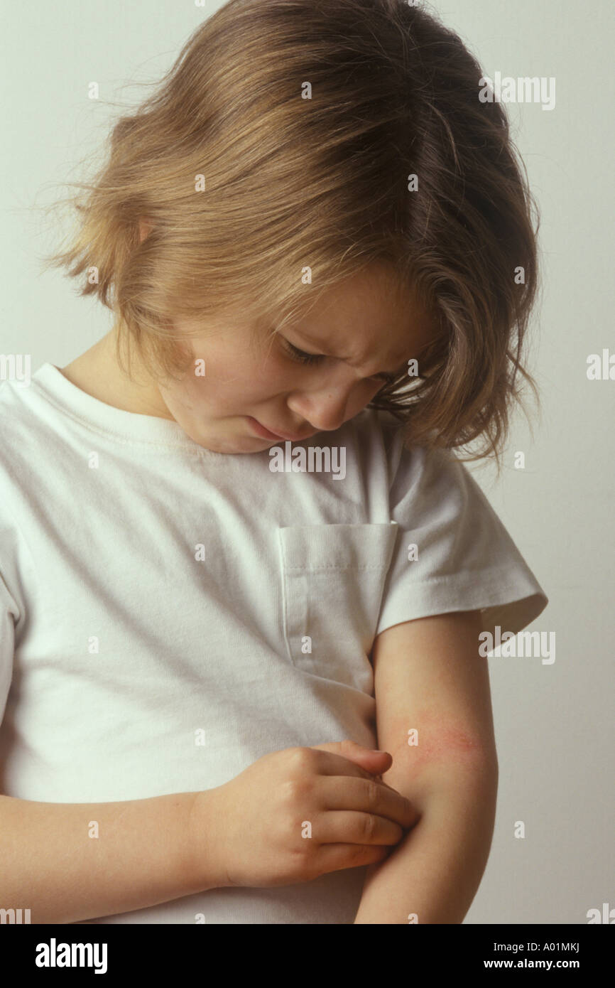 Itching Child Stock Photos & Itching Child Stock Images - Alamy