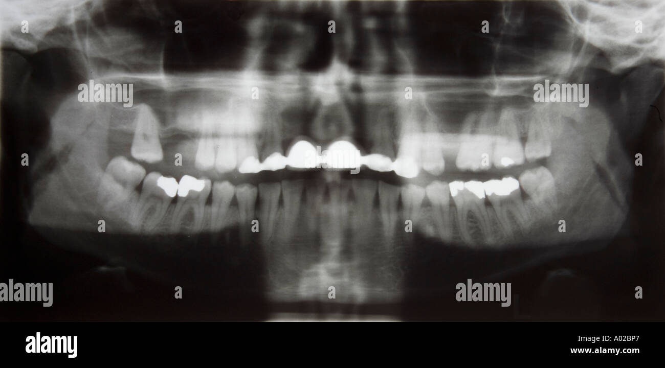 3566 hi-res stock photography and images - Alamy