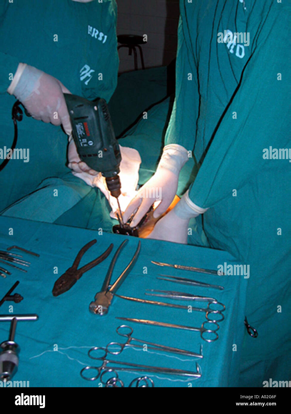 ankle fracture surgery Stock Photo - Alamy