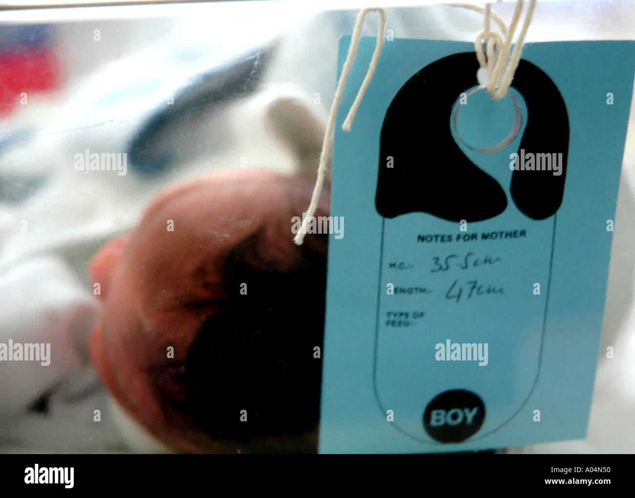 Baby in operating theatre hi-res stock photography and images - Alamy