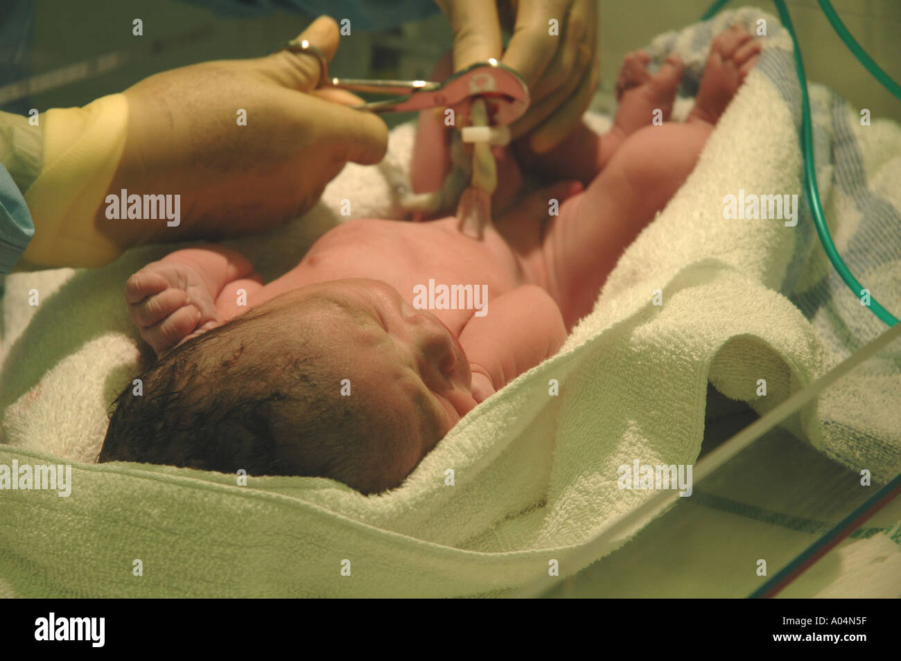 cutting the cord of new born baby Stock Photo - Alamy