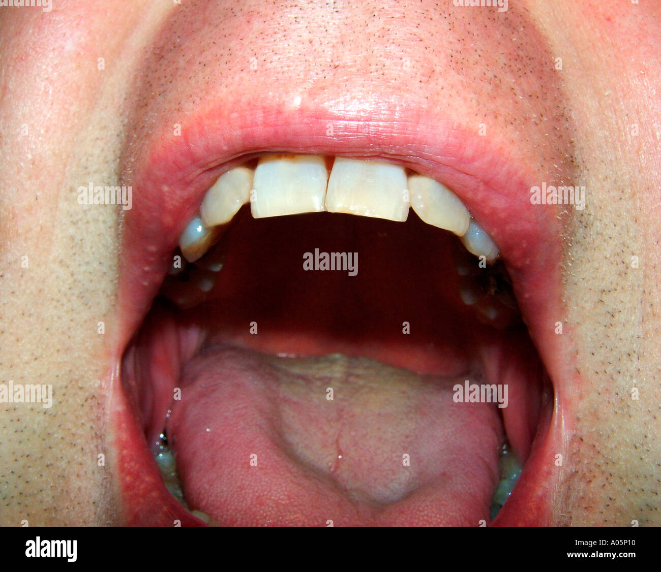 open mouth shouting Stock Photo - Alamy