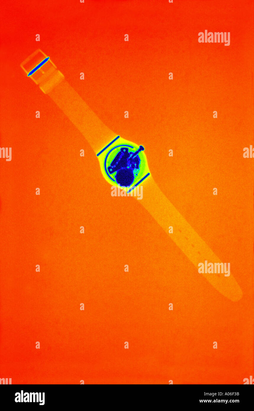 Coloured x ray hi-res stock photography and images - Alamy