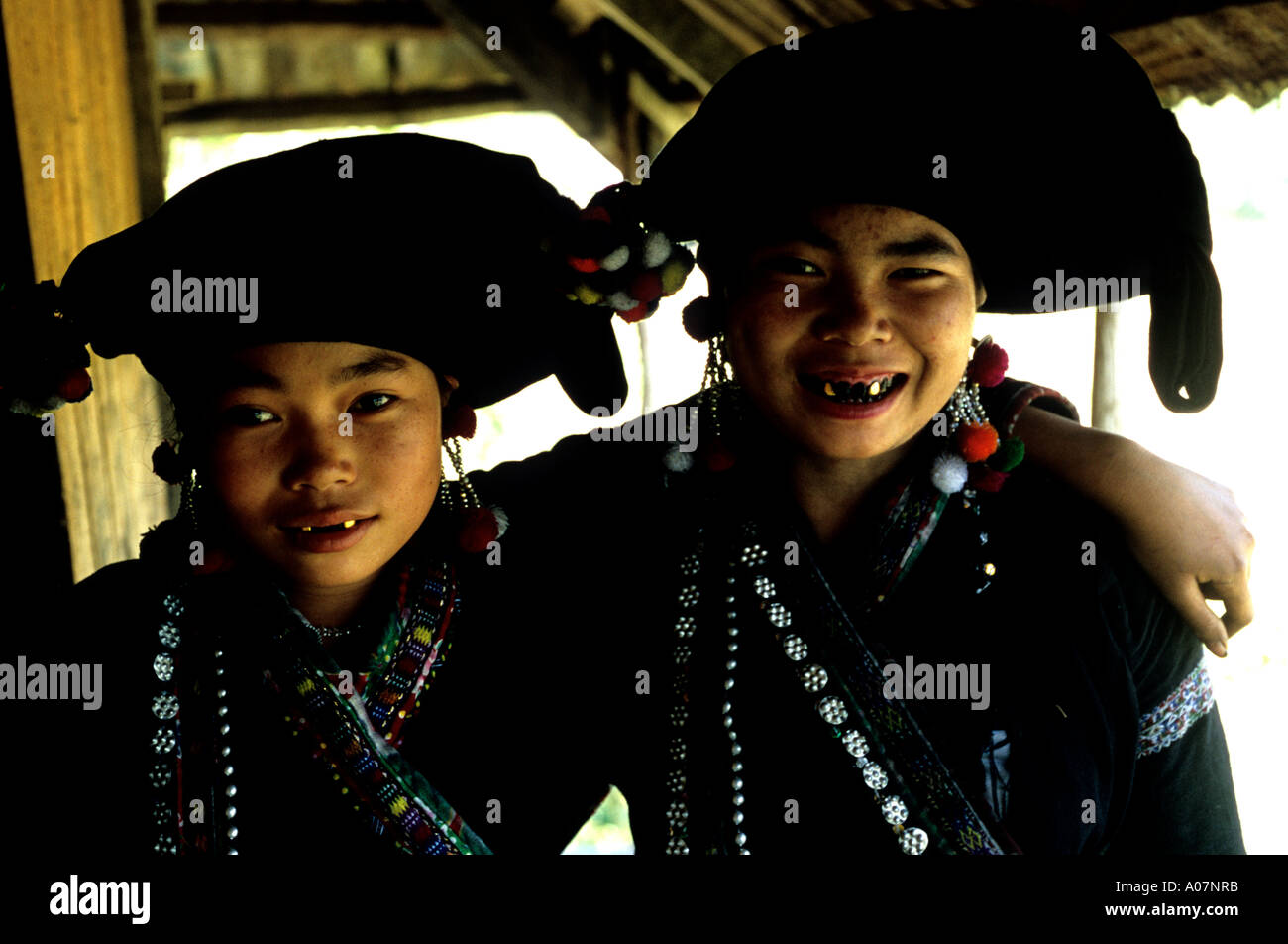 Gold teeth vietnam hi-res stock photography and images - Alamy