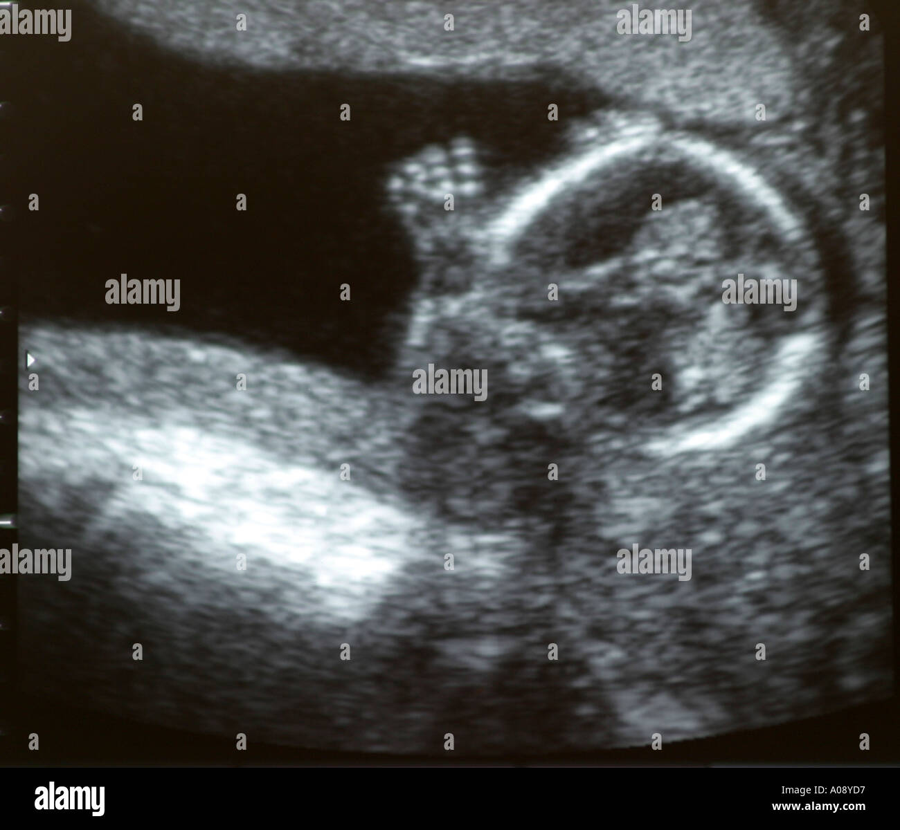 Womb foetus hands hi-res stock photography and images - Alamy