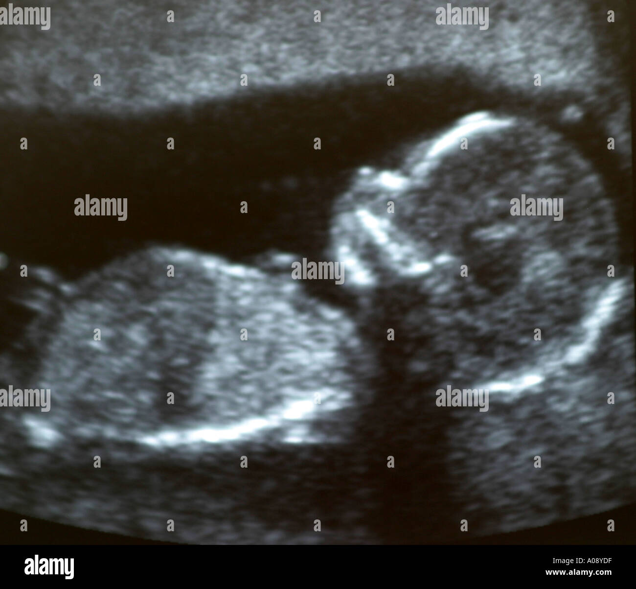 Womb foetus hands hi-res stock photography and images - Alamy