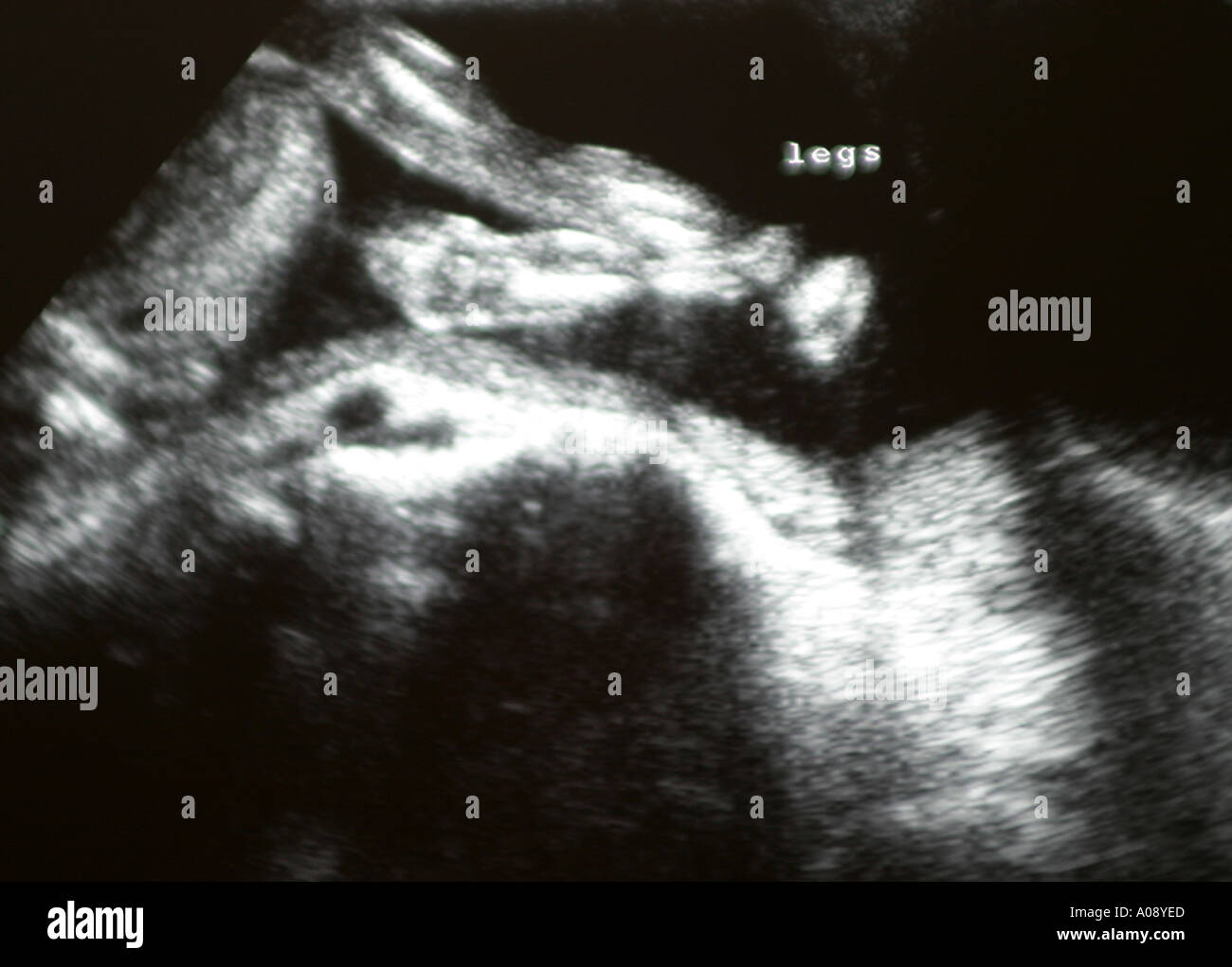 Womb foetus hands hi-res stock photography and images - Alamy