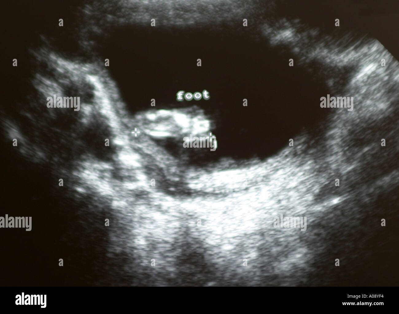 Womb foetus hands hi-res stock photography and images - Alamy